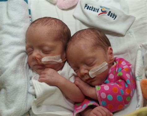 Monoamniotic Twins