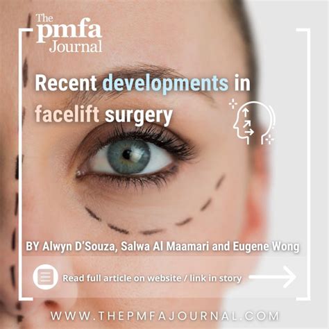 The Pmfa Journal On Linkedin Pmfa Pmfajournal Facelift