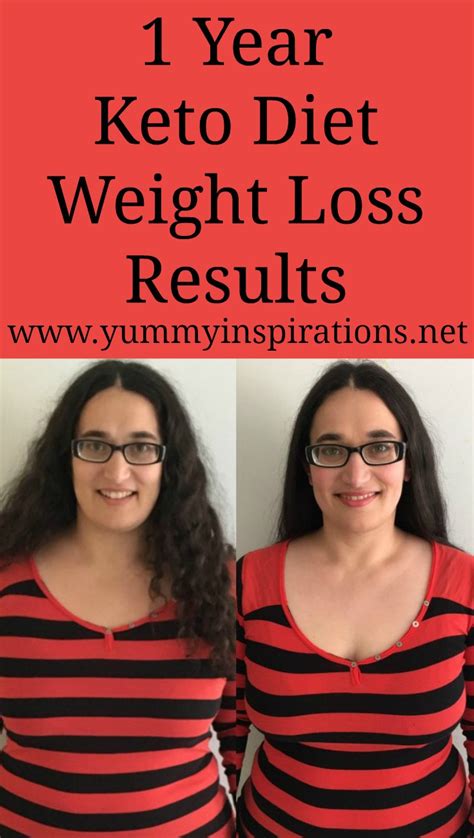 1 Year Weight Loss Results Low Carb Keto Diet Before And After
