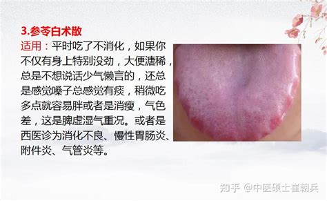 脾虚百病生！一舌一病，一症一药，中成药大分享 知乎