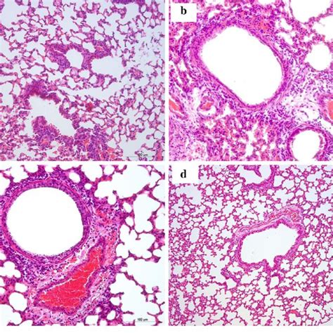 Histopathology Analysis Of Lesions In The Lungs Of Mice Infected With