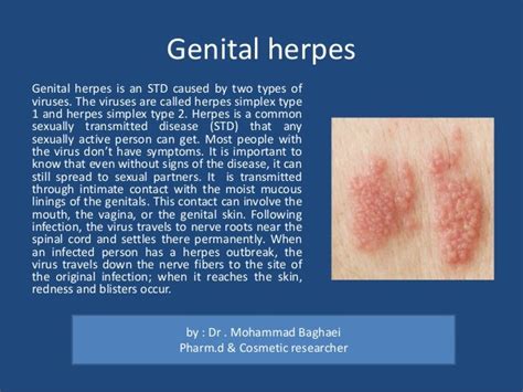 A Brief Review Skin Cysts Lumps And Bumps