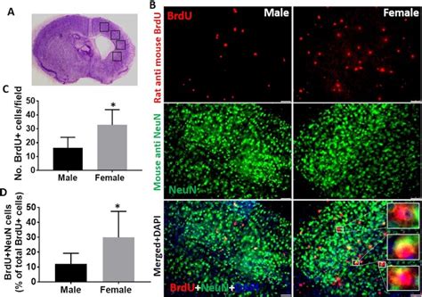 Inflammatory Responses Are Sex Specific In Chronic Hypoxic Ischemic