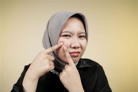 Female Daily Editorial Jerawat Sering Balik Lagi Skincare Terbaru