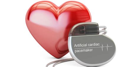 Зүрхний Хэм Алдагдах оноштой Болон пейсмейкертэй хүмүүсийн нэгдэх групп