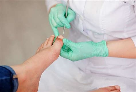 Cuidados Esenciales Para Prevenir Las Complicaciones Del Pie Diabético