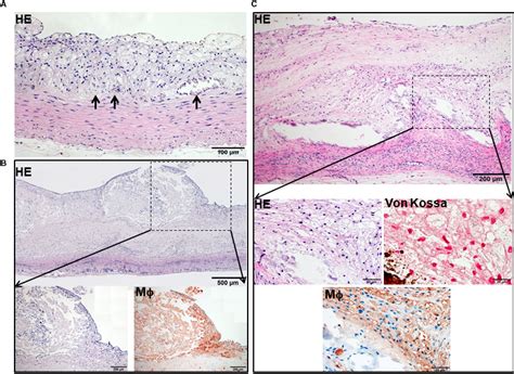 Different Microscopic Patterns Of Aortic Calcification In Tg Rabbits Download Scientific