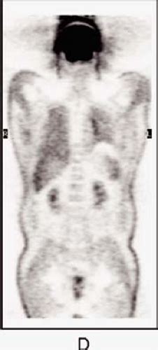 Artifacts Radiology Key