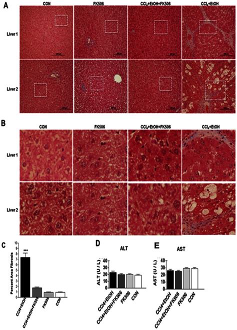 A Massons Trichrome Staining Of The Liver Sections From Rats Treated