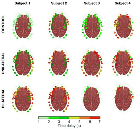 Individual Responses To The Breath Holding Challenge From Four