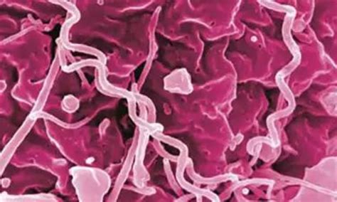 New Paper Based Platform Can Rapidly Detect Antibiotic Resistant Bacteria