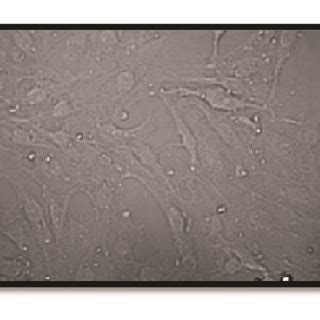 Morphological observation of LX-2 cells after treatment with (a ...