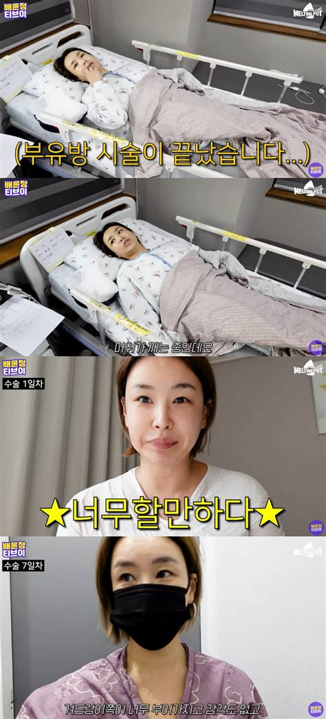 종합 배윤정 부유방 수술 받았다 팔과 겨드랑이 감각 없어 전신마취 할 게 못돼 텐아시아