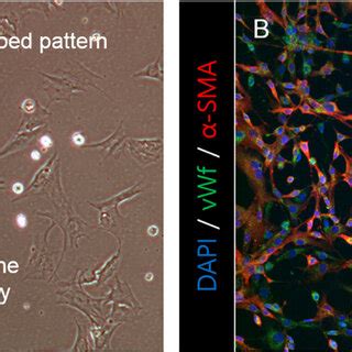 Perfusion System Here We Show The Configuration Of The Perfusion Download Scientific Diagram