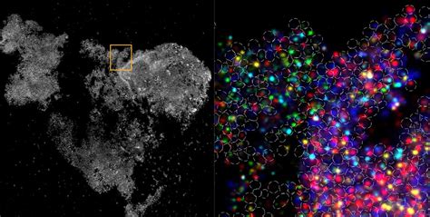 New Technique Surveys Microbial Spatial Gene Expression Patterns Tianqiao And Chrissy Chen
