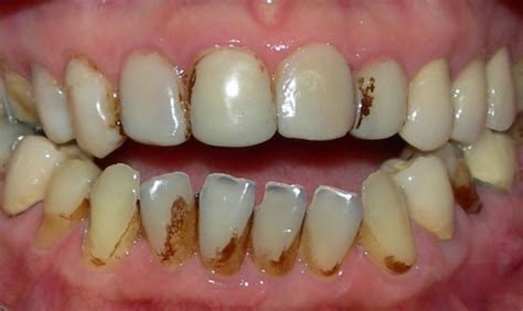 DRA DEISE BASTOS Manchas Nos Dentes