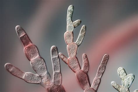 Polysiphonia Under Microscope