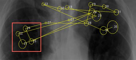 Areas Identified By Rules In This Study A An R Label Spotted Download Scientific Diagram
