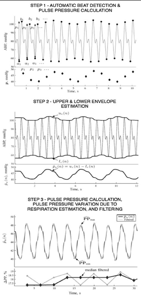Example Of The Steps Performed By An Automatic Pulse Pressure Variation Download Scientific