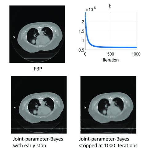 Comparison Of Reconstructed Images Between The Conventional Map And Download Scientific Diagram