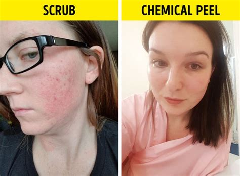 10 Common Skin Care Mistakes That Are Damaging Your Face Bright Side