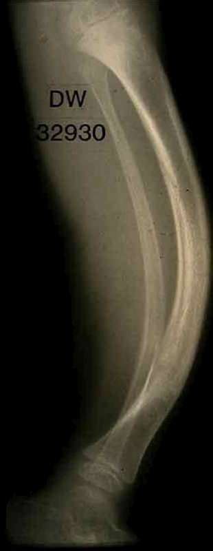 Sabre Tibia