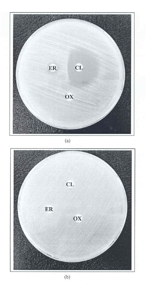 Example Of Double Disk Test D Test Demonstrating Erythromycin Er