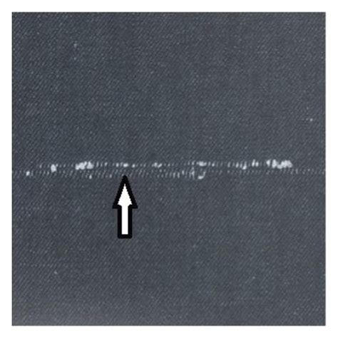 Some Fabric Defects Which Occur During Manufacturing Processing A
