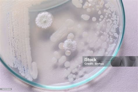 피치아는 교육을 위한 현미경의 밑에 가족 사카로미세타아에 있는 효모의 속입니다 발효에 대한 스톡 사진 및 기타 이미지 발효 현미경 효모 Istock