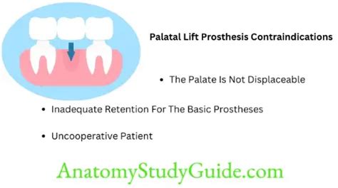 Removable Palatal Augmentation Prosthesis Anatomy Study Guide