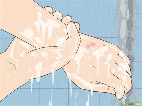 How To Tell If A Cat Has Rabies Symptoms Prevention More