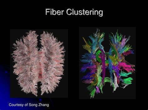 Ppt Diffusion Tensor Imaging Frontal Executive Function In Vascular