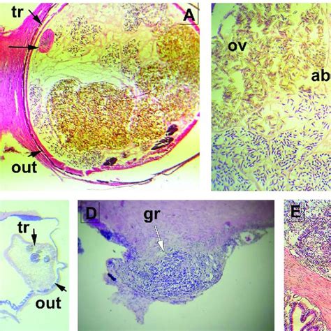 Fig The Histological Structure Of Exophytic Neoplasms And The Picture Download Scientific