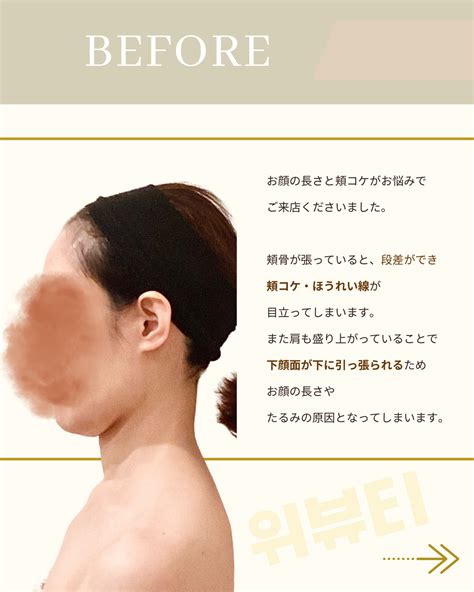 【before After】頬骨管理＋面長管理＋美人肩管理 を受けられたお客様 Webeauty大阪店