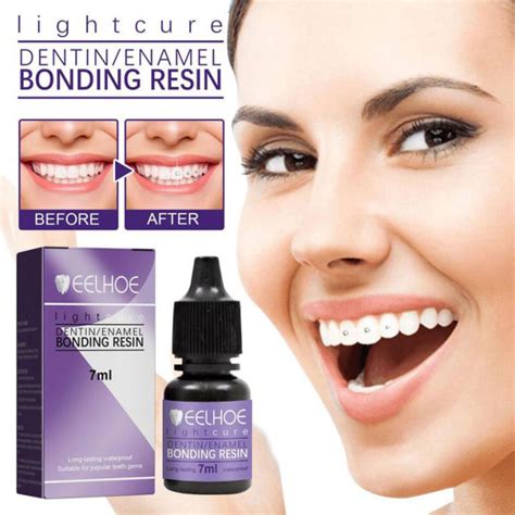 Tooth Gem Glue Dental Self Adhesive Gluel For Tooth Gems Diamond Kit