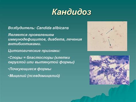 Клиническая цитология Воспалительные заболевания шейки матки презентация онлайн