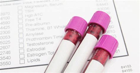 Kandaki Alyuvarları Belirten Rbc Eritrosit Nedir Rbc Düşüklüğü Ve Yüksekliği Ne Anlama Gelir