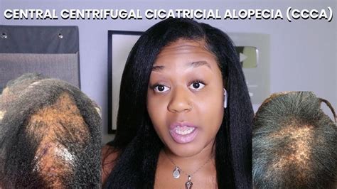 CCCA Nightmare Black Women S Hair At Stake Join The Solution In Part