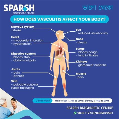 Vasculitis Sparsh Diagnostic Center