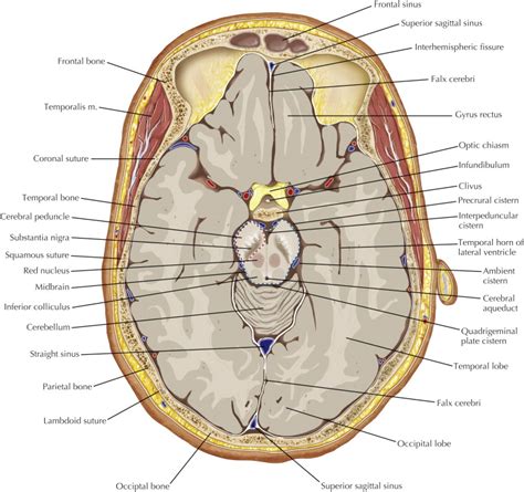 Brain Radiology Key