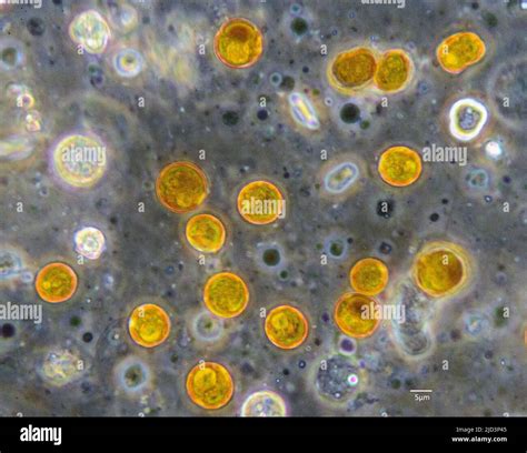 Microscopic Photo Of Symbiotic Algae Zooxanthellae Of The