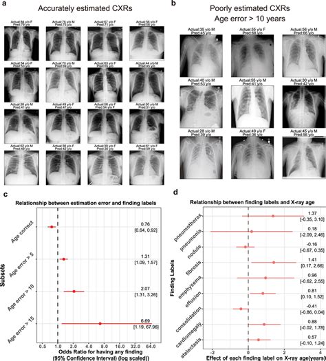 Characteristics Of Images Resulting In Inaccurate Age Estimation By The Download Scientific
