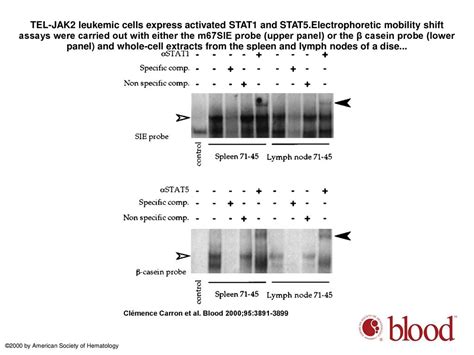 Tel Jak2 Transgenic Mice Develop T Cell Leukemia Ppt Download
