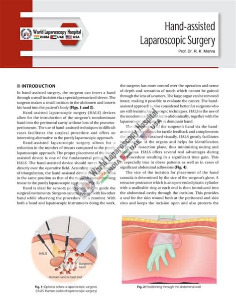 Laparoscopic Splenectomy At World Laparoscopy Hospital Pdf