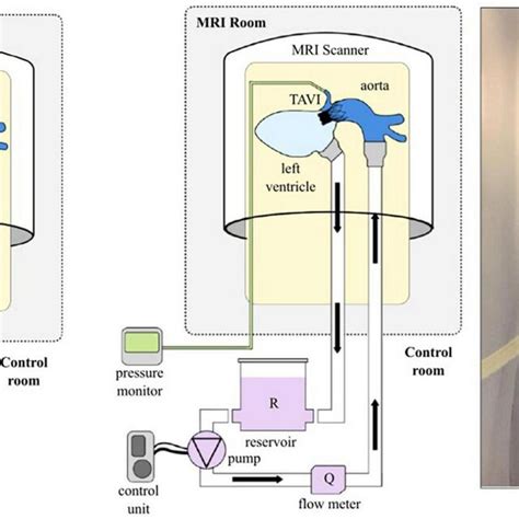 Schematic Representation Of The Pulsatile Flow Setup Left And
