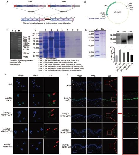 Blockade Of Complement Activation In Bullous Pemphigoid By U Chinese Medical Journal