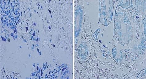 Mastocytes In Hypertrophic A And Atrophic Cutaneous Lp B ×400 Download Scientific Diagram