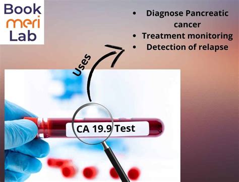 Ca 199 Test Price Purpose Range And Results 2025 • Bookmerilab