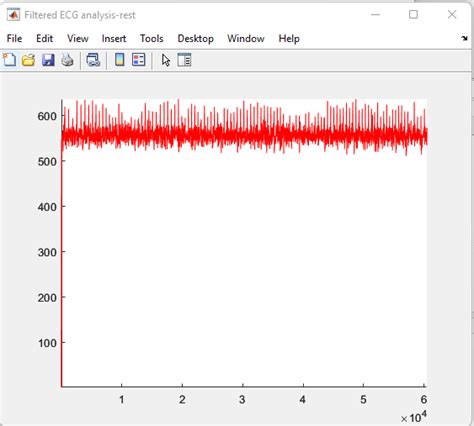 Pan Tompkins Algorithm On Ecg Rmatlab