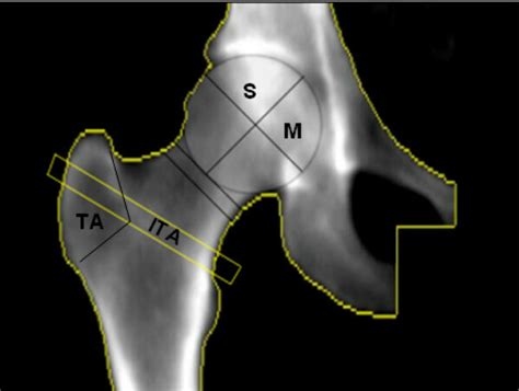 DXA Image That Shows The Parameters Of The DXA Scan That Are Part Of Download Scientific